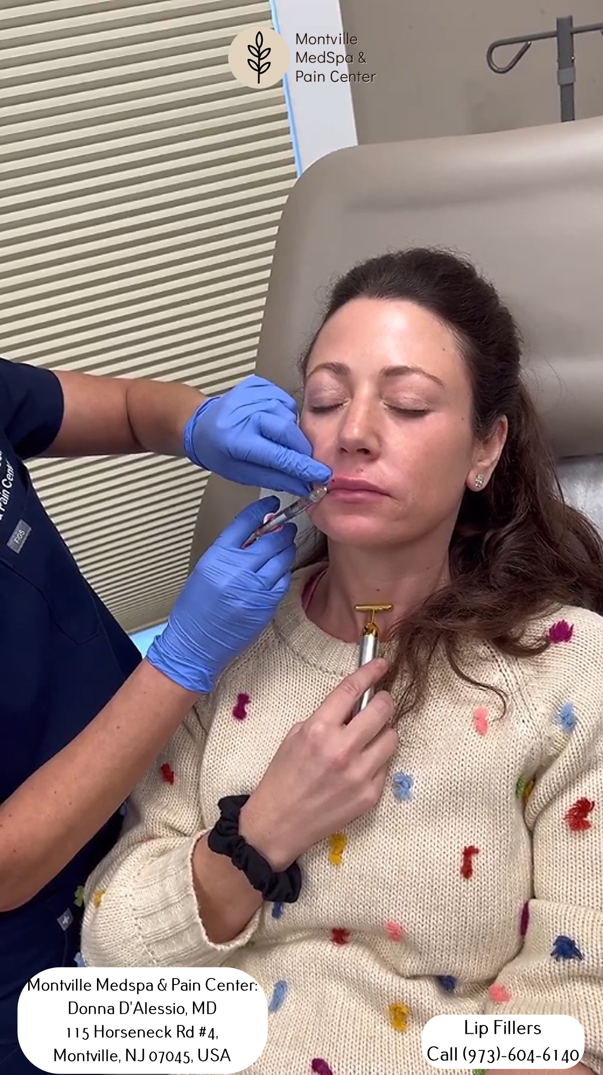 Kylie Jenner’s Lip Filler Transformation: The Inside Story on Her ...